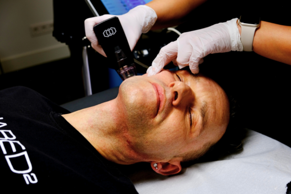 Morpheus8 | De Huidkliniek